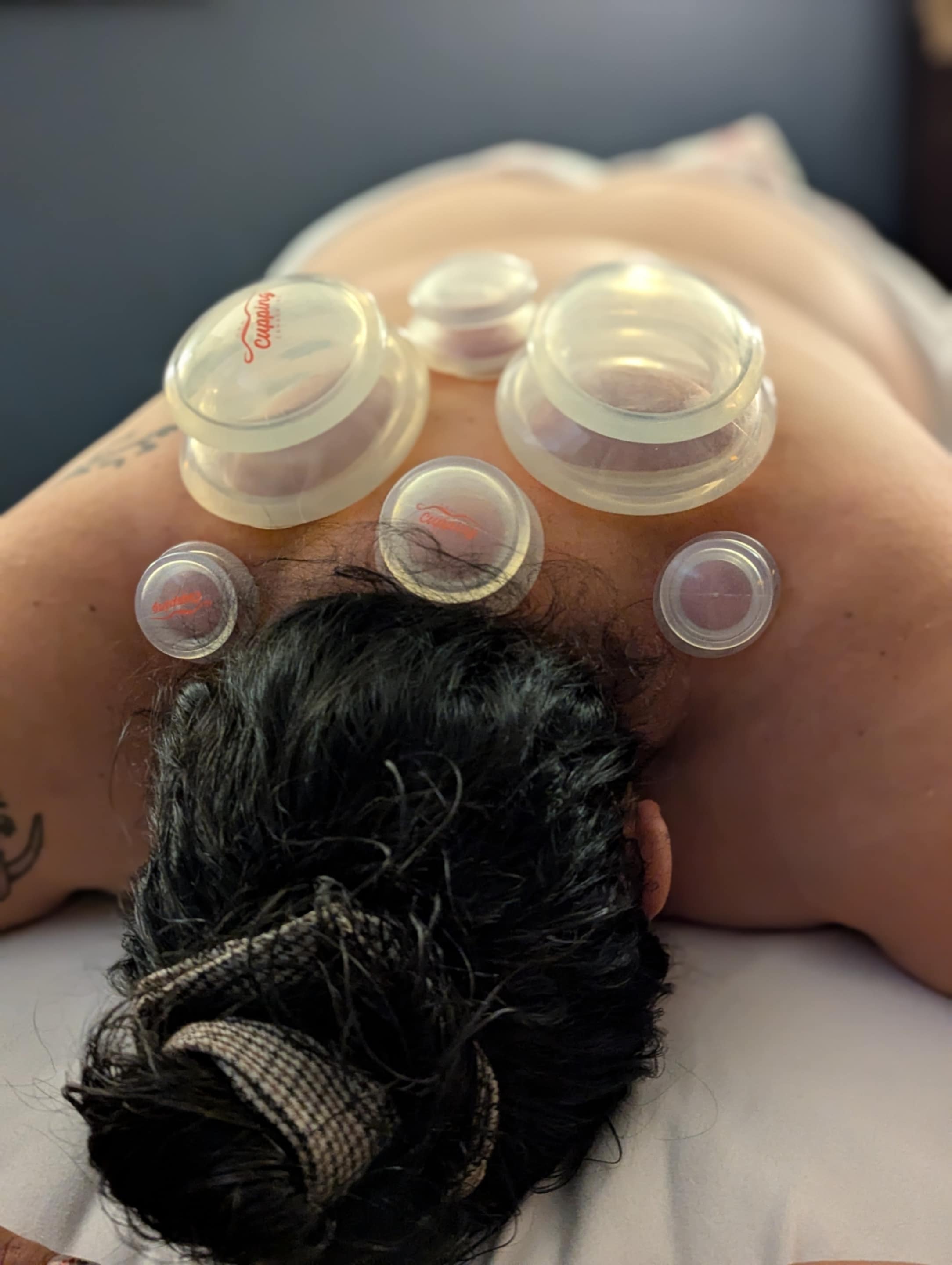 Cupping – ADD Movement Massage Therapy